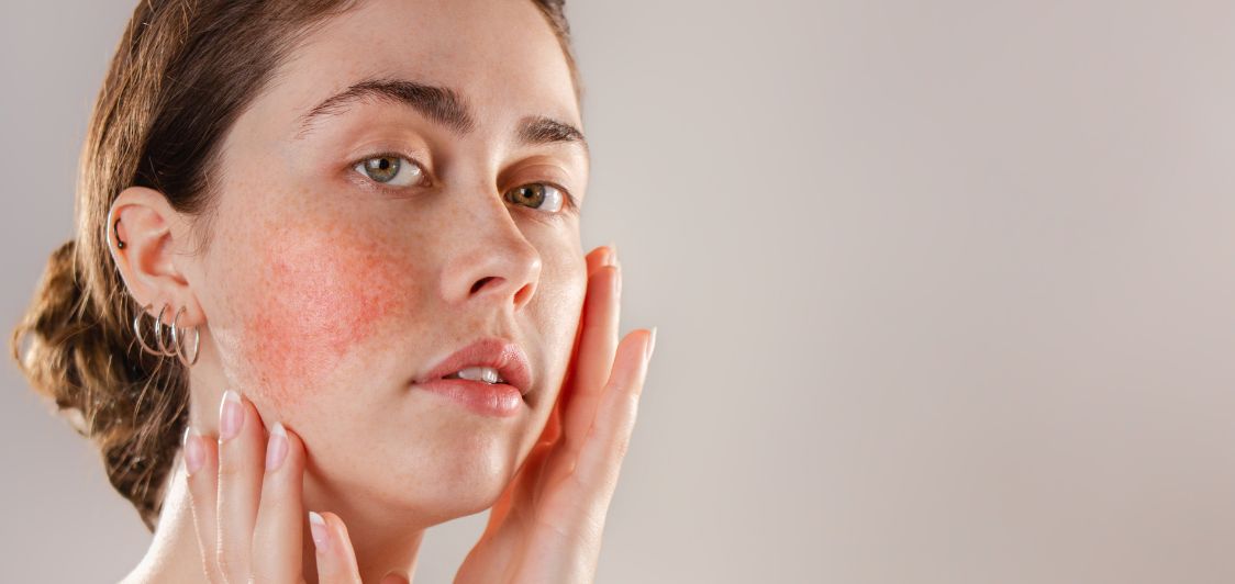 DE LA BAVE D'ESCARGOT POUR EN FINIR AVEC LA DERMATITE ATOPIQUE – Mlle ...